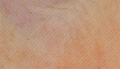 Female 052 Albedo Map