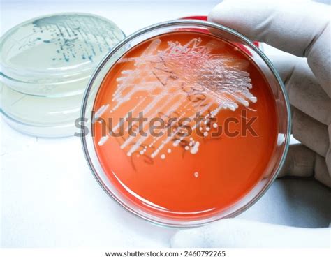 Staphylococcus Aureus Gram Positive Gram Variable Nonmotile Coccus