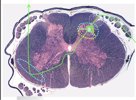 Spinothalmic Tract Lower Lumbar Diagram Quizlet