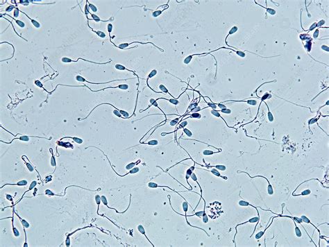 Sperm Cells Stock Image P6240160 Science Photo Library