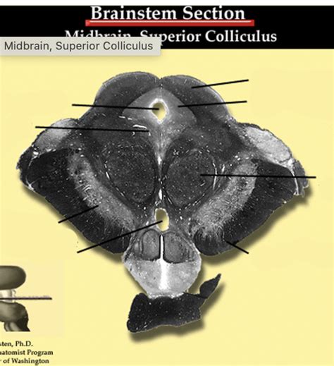 Brainstem Section Midbrain Superior Colliculus Diagram Quizlet