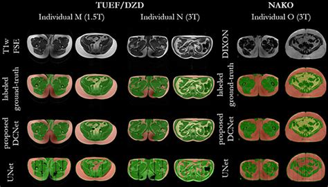 Fully Automated And Standardized Segmentation Of Adipose Tissue Compartments Via Deep Learning