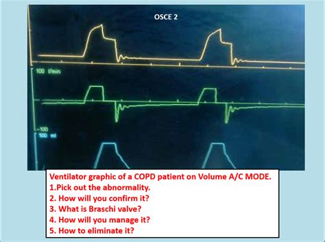 Osce Anaesthesia News