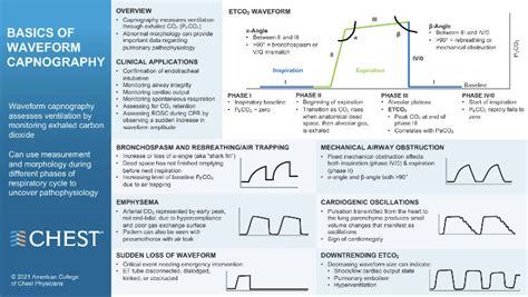 If You Know What A Normal Waveform Looks Like You Can Recognize An Abnormal One If You Can