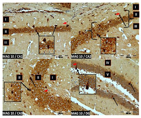 Control Group Immunoreactivity Of Pv Ir Neurons In The Fields Ca1 Ca3 Download Scientific