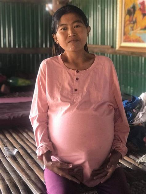 សង្វេគណាស់ ស្ត្រីកំសត់ទីទាល់ក្រ រស់ស្ពាយជំងឺចម្លែក៥ឆ្នាំមកហើយ ដង្ហើយរកសប្បុរសជន សូមជួយគាត់ផង