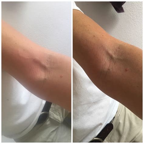 Wtf I Hate My Left Arm Another Missed Shot Post Would You Mind Taking