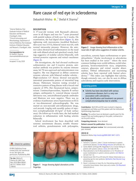 Pdf Rare Cause Of Red Eye In Scleroderma Images In…