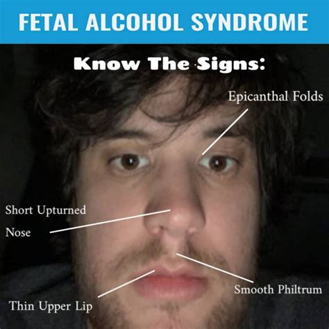 Great Googly Moogly R Supermegashow