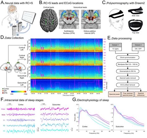 Fahim Anjum On Linkedin Parkinsonsdisease Sleepresearch Neuroscience Dbstherapy