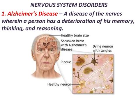 Nervous System Diseases And Disorders