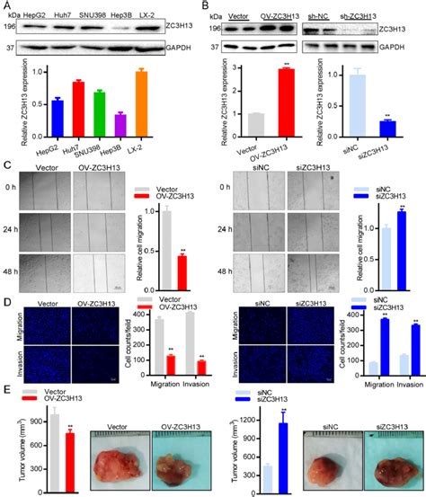 Upregulating Zc3h13 Inhibited The Aggressive Behaviors Of Hcc Cells Download Scientific