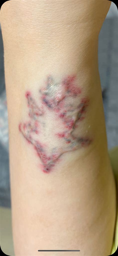 피부과 가야할까요 지식in