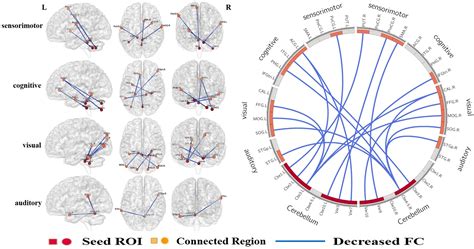 Cerebellum Regulating Cerebral Functional Cortex Through Multiple