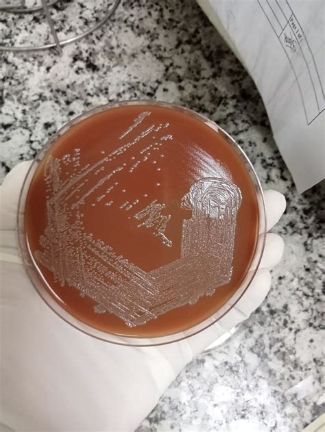 Enterococcus Faecalis 29212 On Chocolate Agar Medium Microbiology Lab Microbiology Medical