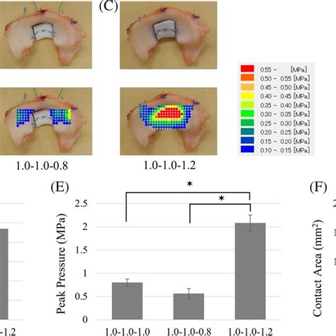 Effect Of Implanted Scaffold Circumferential And Radial Sizes On