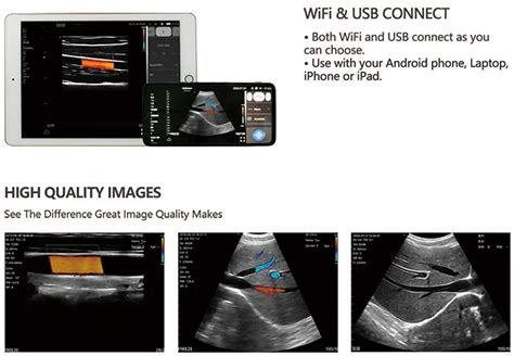 3 In 1 Linear Convex Double Probes Portable Ultrasound