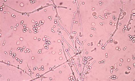 Yeast Cells Budding