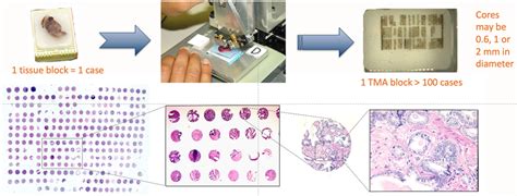 Christopher A Moskaluk Md Phd Awarded 3 2 Million To Fund Cooperative Human Tissue Network