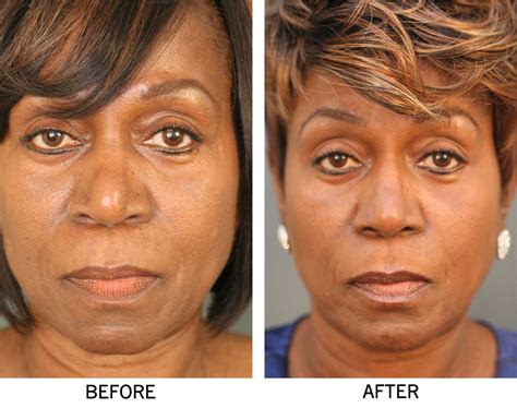 African American Nose Shapes