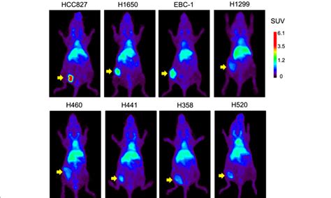Representative [ 64 Cu]cu Dota Cetuximab Positron Emission Tomography Download Scientific