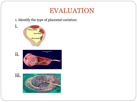 Abnormal Placenta Pptx