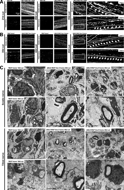 Long Term Axon Survival After Sciatic Nerve Lesion In Nls Wld S