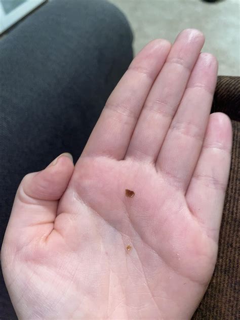 Lots Of Random Bugs In My House Are These Bedbug Casings Or Am I Paranoid Rbedbugs