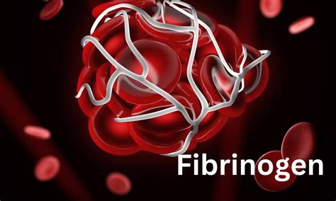 Fibrinogen Depletion In Stroke Patients Under Bridging Therapy Increases Bleeding And Mortality