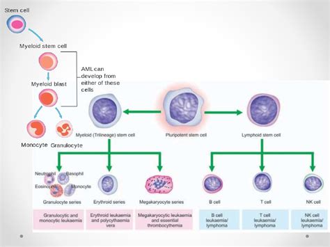 Acute Myeloid Leukemia Stages