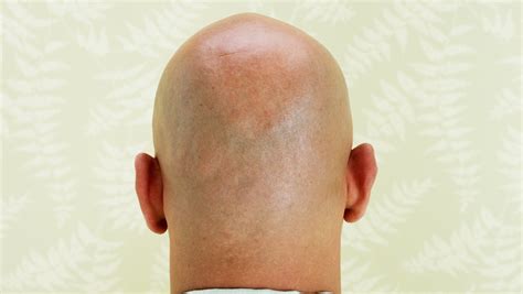 Study Bald Men Appear More Dominant