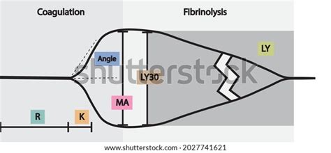 Thromboelastography Teg Blood Coagulation Analysis Chart Stockvector