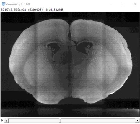 Registration Accuracy Image Analysis Imagesc Forum