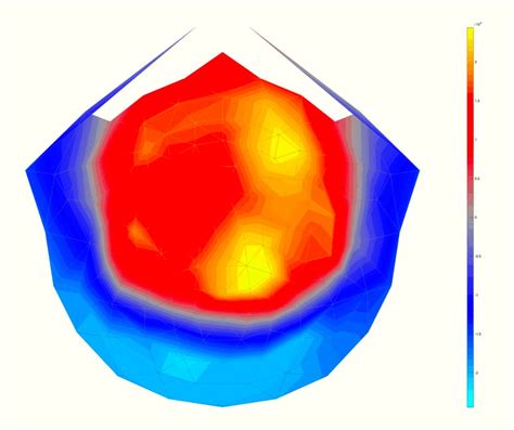 Challenges In Eeg Source Localization Bugs Brainstorm