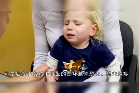 3岁女孩哭喊手臂疼，家人送到医院后，医生惊呼：再晚要截肢了手臂医生家人