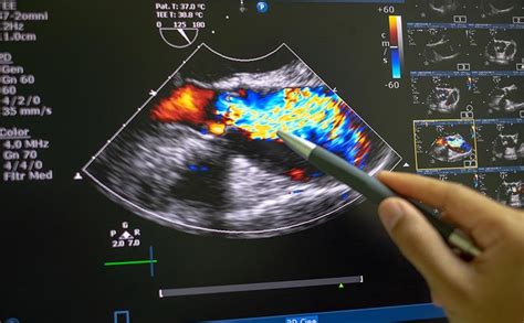 Em Ultrasound Section Six Steps To Mastering Your Echocardiography