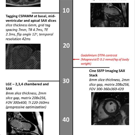 Protocol For Cmr Scan Abbreviations Cspamm Complementary Spatial Download Scientific Diagram