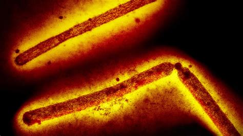 The Fda Plans To Reevaluate Fluoride Supplements