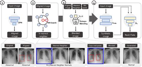 Figure 1 From Generative Residual Attention Network For Disease