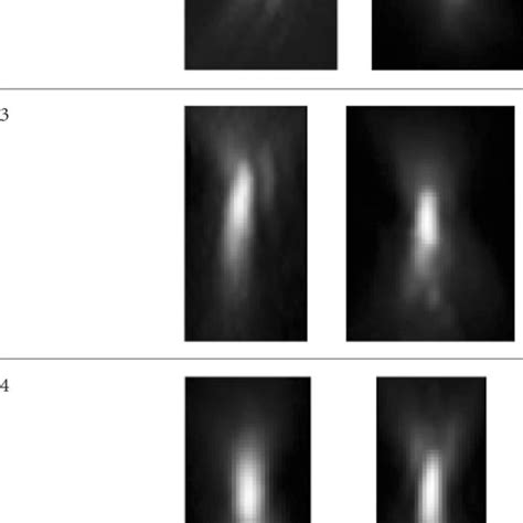 Representative Psfs For Each Scoring Value Quality Score Download Table