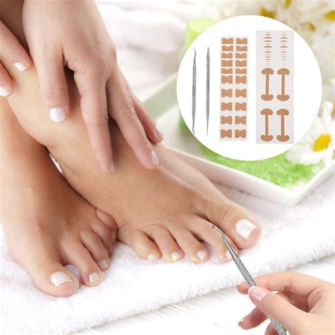Toenail Corrector Patch Artofit