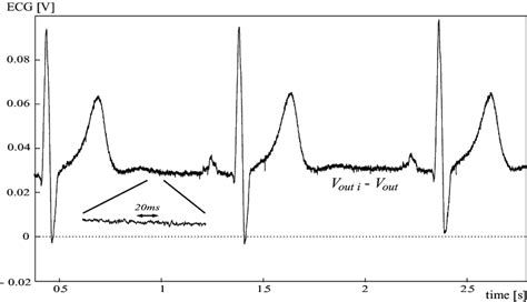 13 The Digitally Calculated Difference Of The Two Pseudo Differential
