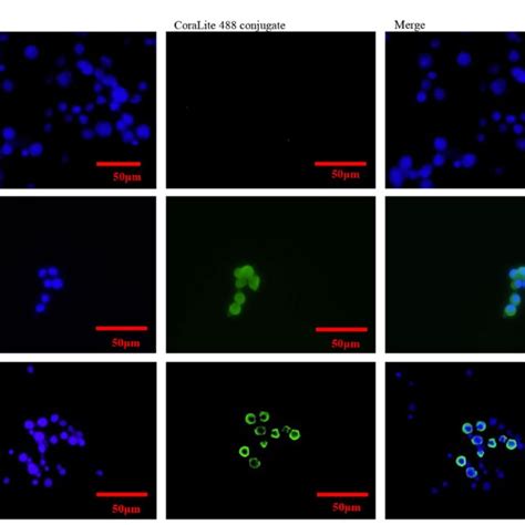 Identification Of Recombinant Plasmids By Double Digestion And Bacmid Download Scientific