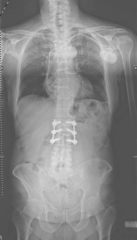 Michael Wang Linkedinde Yayınladı