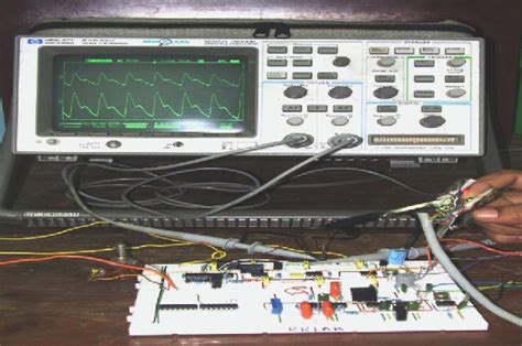 Figure 1 From A Novel Approach For Motion Artifact Reduction In Ppg Signals Based On As Lms