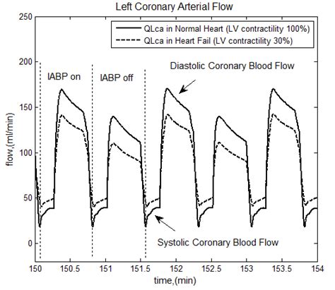 Arterial Pressure Waveform With Iabp 1 2 Upper Panel And With Iabp Download Scientific