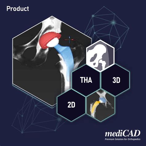 Medicad® On Linkedin Pre Operative Templating In Tha Using A Short