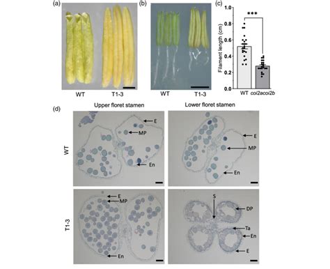 Morphological Comparison Of Anthers Between Wild Type Wt And Coi2a