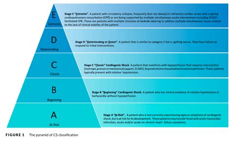 Cardiogenic Shock Cardio Guide