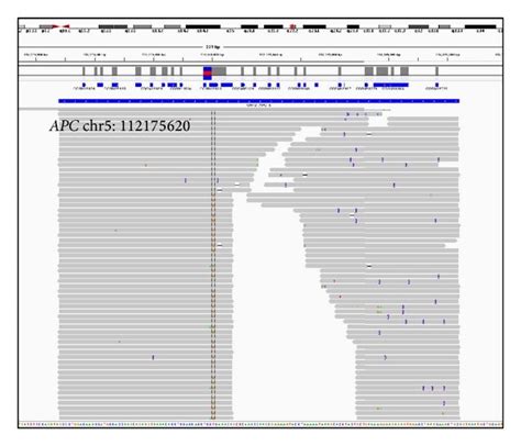 Representative Snapshots Of Integrative Genomics Viewer Igv Broad Download Scientific Diagram